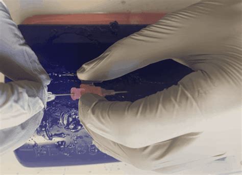Ultrasound Guided Peripheral IV Insertion Placement And Access Made