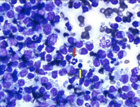 Exam Cytology Round Cell Tumors Flashcards Quizlet
