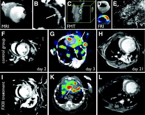 Multimodality Cardiovascular Molecular Imaging Part II Circulation