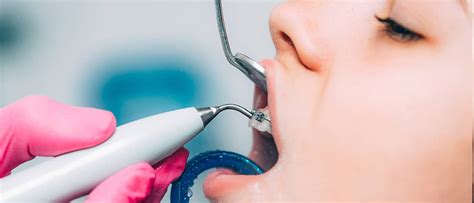 Periodontal Scaling And Root Planing Highlands Ranch Periodontics