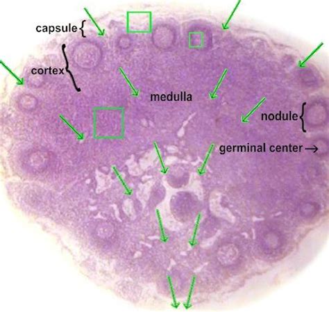 Lymph Node Medical Laboratory Science Med School Advice Histology