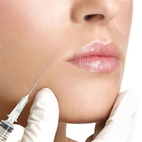 Injections d acide hyaluronique dans les lèvres à Bordeaux