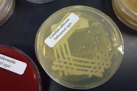 Is There A Blood Test For Candida At Bernadine Trombley Blog
