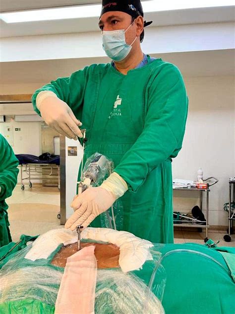 Cirurgia Endosc Pica Da Coluna O Que E Quais As Vantagens