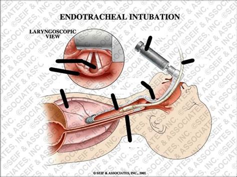 Pin On Respiratory System Off Gbu Presnenskij Ru