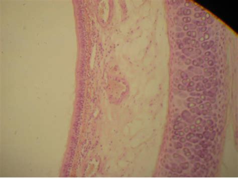 Respiratory Histology Flashcards Quizlet