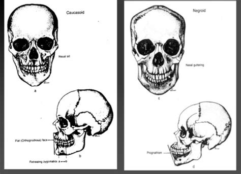 Forensic Anthropology Flashcards Quizlet