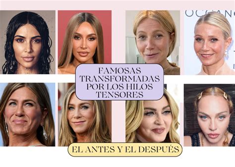Famosas antes y después de hacerse los hilos tensores Top Beauty by
