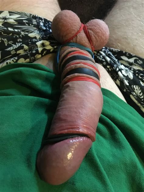 Cock And Ball Bondage With Rubber Bands And Cockrings 15 Nude Pics Xhamster