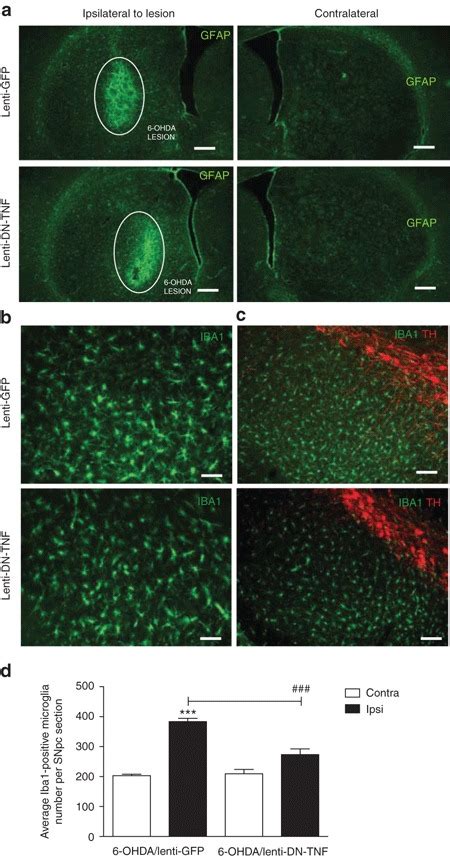 Effects Of Nigral DN TNF Gene Transfer On Microgliosis And