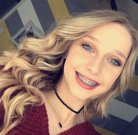 Braces Girlswithbraces Metalbraces Braces Girls Cute Girls With