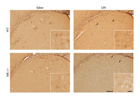 LPS Induced Astrocytosis In The Striatum Of WT And MK Mice A