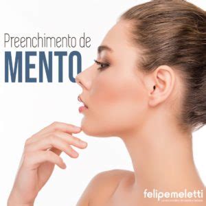 Preenchimento De Mento Cl Nica Felipe Meletti