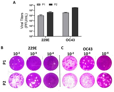 Improved Plaque Assay For Human Coronaviruses 229E And OC43 PeerJ