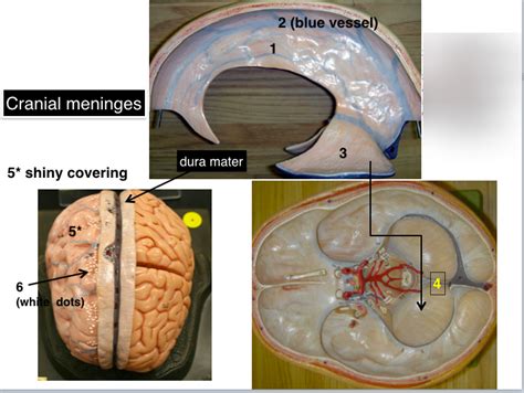 Cranial Meninges Diagram Quizlet