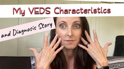 My VEDS Characteristics And Diagnosis Story Vascular Ehlers Danlos