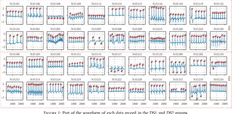 figure 1 from real time arrhythmia classification algorithm using time domain ecg feature based