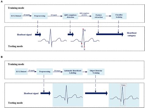 frontiers beat level interpretation of intra patient paradigm based on object detection