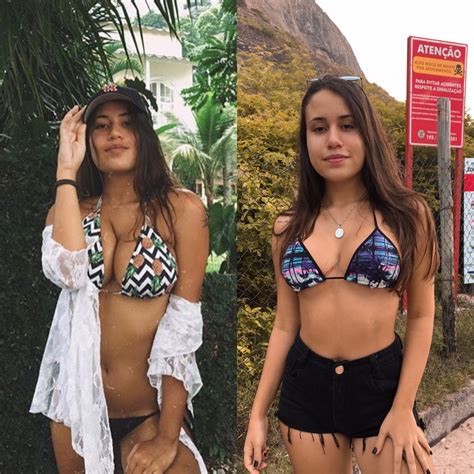 Mamoplastia Redutora Antes E Depois Fotos Alpinemoms