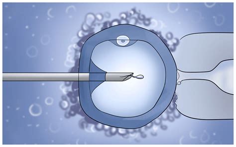 IntraCytoplasmic Sperm Injection ICSI Infertility Treatment Jalgaon
