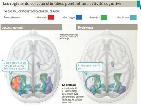 L imagerie du cerveau dévoile les secrets de la dyslexie Dyslexie