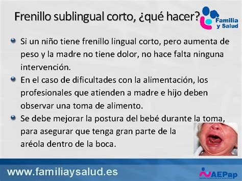 Frenillo Lingual Corto Y Lactancia Materna M Rosario