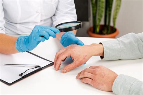 Eczema Vs Psoriasis How To Tell Them Apart Goodless Dermatology