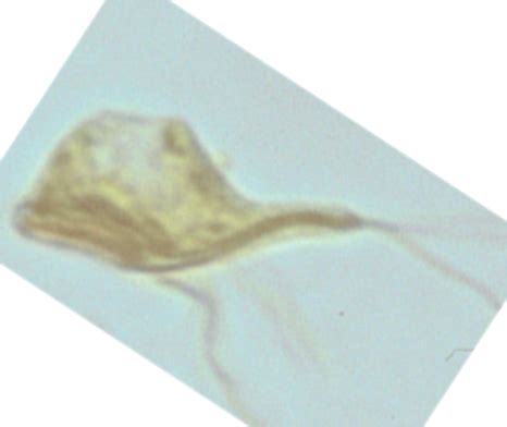 L And Part Protozoan Parasites Protozoa Overview And Giardia