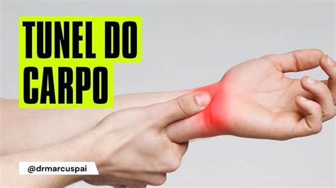DOR NAS MÃOS Síndrome do Túnel do Carpo Causas Sintomas