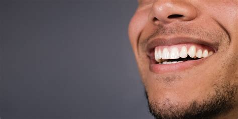 Gum Grafting Huntington Beach CA Dr Brent O Nichols