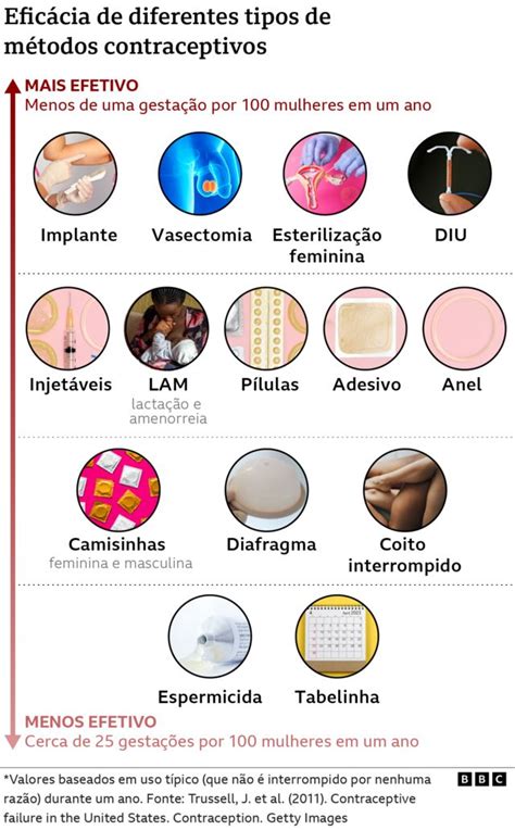 DIU quais as chances de engravidar usando método contraceptivo BBC
