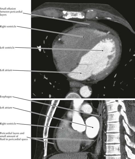 Thorax Radiology Key