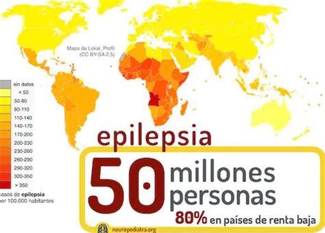 Epilepsia Una De Cada 100 Personas Sufre Este Trastorno Del Cerebro
