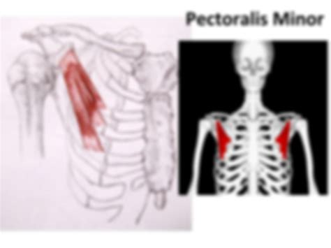Solution Ccmh Gross Anatomy Palpation Lecture Pectoral Girdle