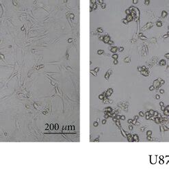 Apatinib Induces Loss Of Cell Viability And Promotes Cell Cycle Arrest