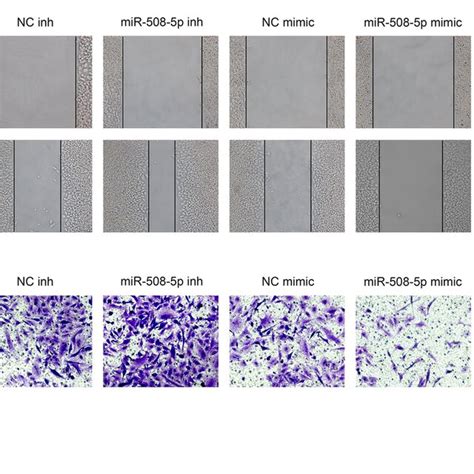 MiR 508 5p Inhibited The Migration And Invasion Of Human Melanoma Cells