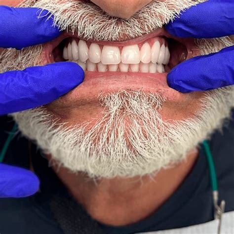 Implante Dentário Só Sorriso Odontologia Recreio do Bandeirantes