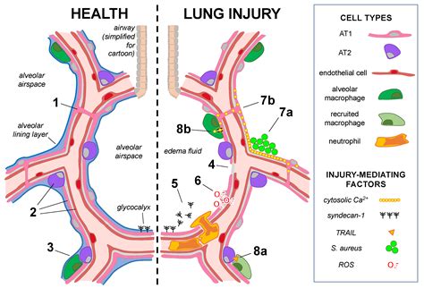 The Alveolar Epithelium At Homeostasis Encyclopedia MDPI