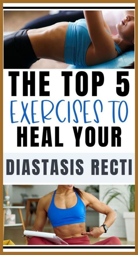 The Top 5 Exercises To Heal Your Diastasis Recti Artofit