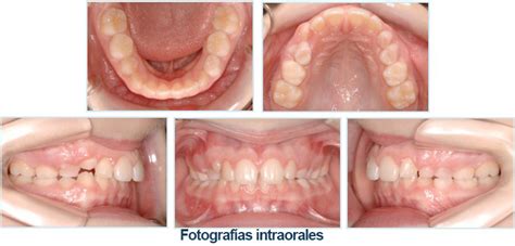 Fotografía dental con tu móvil Tips para sacarle el mayor beneficio