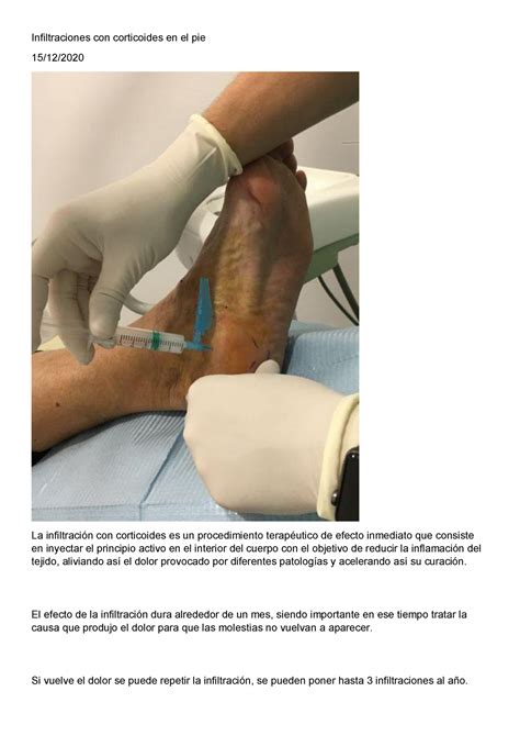 Infiltraciones Con Corticoides En El Pie Infiltraciones Con