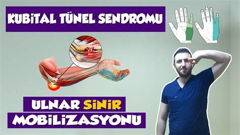 Dirsekte Sinir Sıkışması Kubital Tünel Sendromu Ulnar Sinir