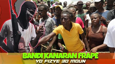 B Ndi Kanaran Fizye 30 Moun Nan Popilasyon Ki Te Vin Bay Bwa Kale A