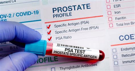 Understanding The Psa Test And Psa Levels Tulsa Procedure Off