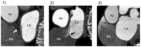 JCDD Free Full Text Diagnostic Performance Of Cardiac Computed