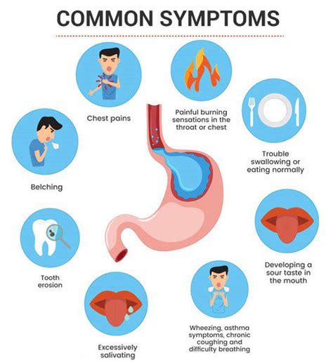 Gastroesophageal Reflux Disease Gerd Bims Hospital
