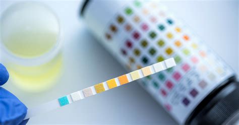 Urinalysis How To Interpret Your Results GMP Medical Hialeah Florida