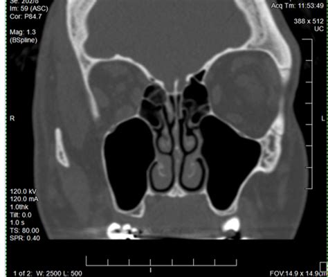 Lecture Neuroimaging Diagram Quizlet