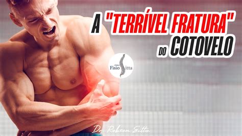 A TRÍADE TERRÍVEL do COTOVELO FRATURA LUXAÇÃO e sua RECUPERAÇÃO