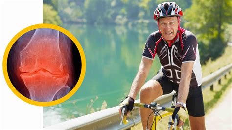 Bicicleta e Artrose no Joelho Clínica do Joelho